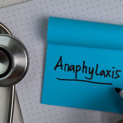 Anafilaxiás sokk, az anafilaxia okai, tünetei és kezelése - Allergiaközpont